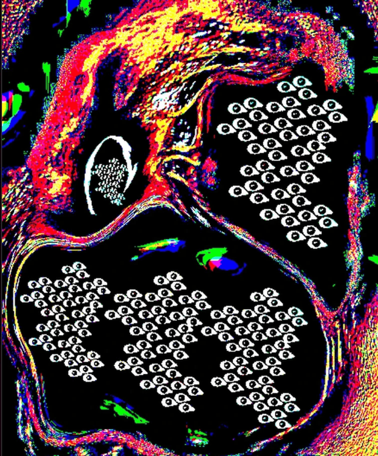 Phase 1000000 Peewoop987986985984173 The Uncanny Incredible Wiki