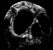 MIBU: Topsik22’s Phases 164000 - 2,000,000 | The Uncanny Incredible ...