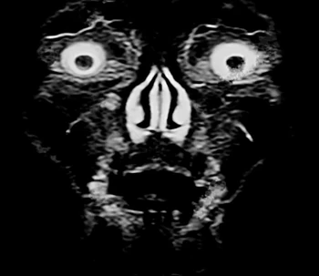 Phase 193 (Gold XD) | The Uncanny Incredible Wiki | Fandom