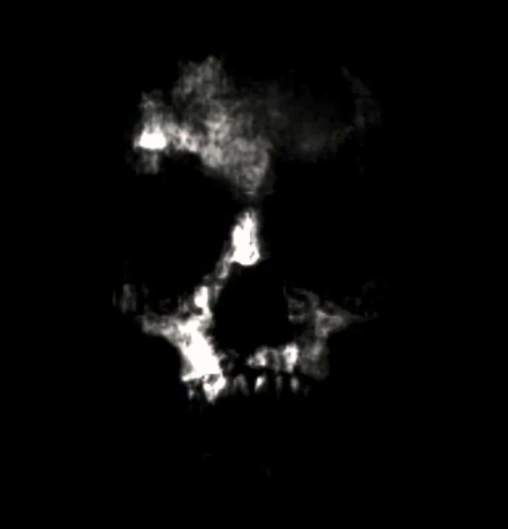 Phase 522 (Stist)/Phase 1240 (ZanskuyAE) | The Uncanny Incredible Wiki | Fandom