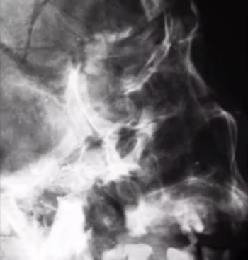 Phase 184 (Mr. Penwell) | The Uncanny Incredible Wiki | Fandom