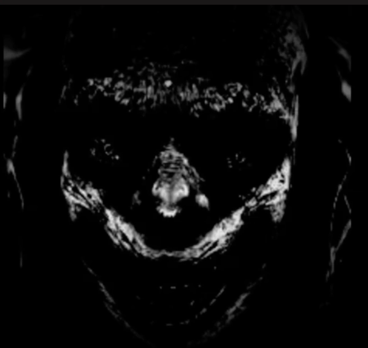 Phase 301 (Wicoy) | The Uncanny Incredible Wiki | Fandom