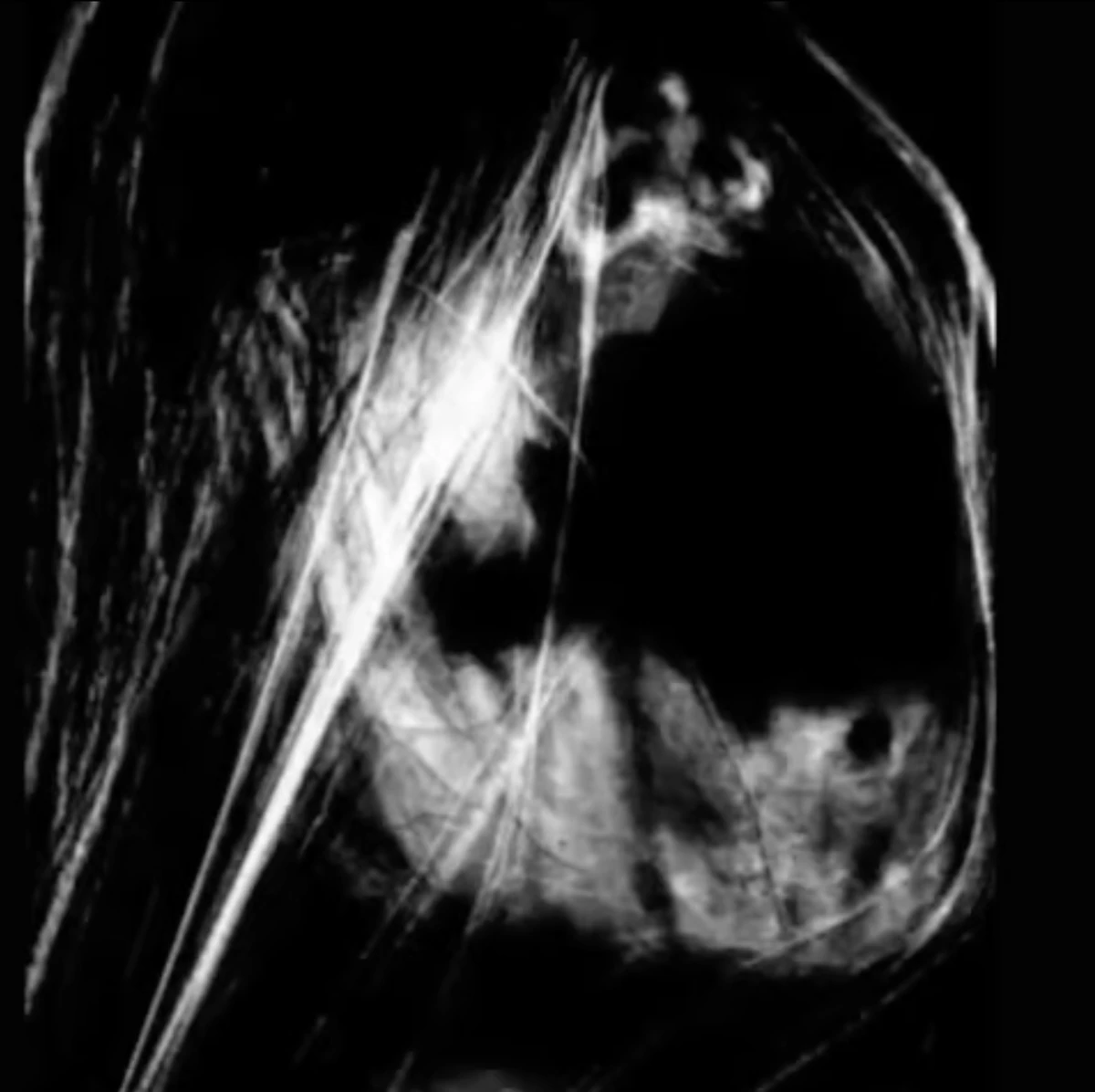 Phase 3420 (ZanskuyAE) | The Uncanny Incredible Wiki | Fandom