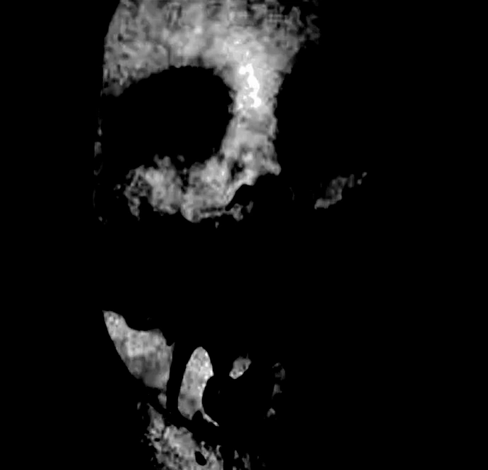 Phase 181 (MIBU 250 Phases)/Phase 249 (Painful Extension) | The Uncanny ...