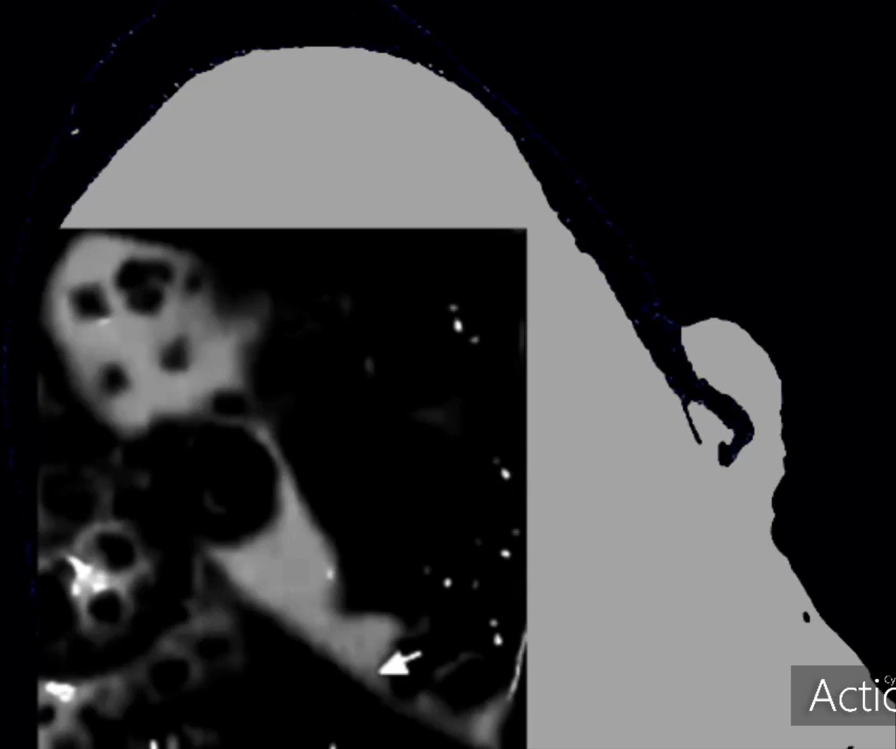 Discuss Everything About The Uncanny Incredible Wiki | Fandom