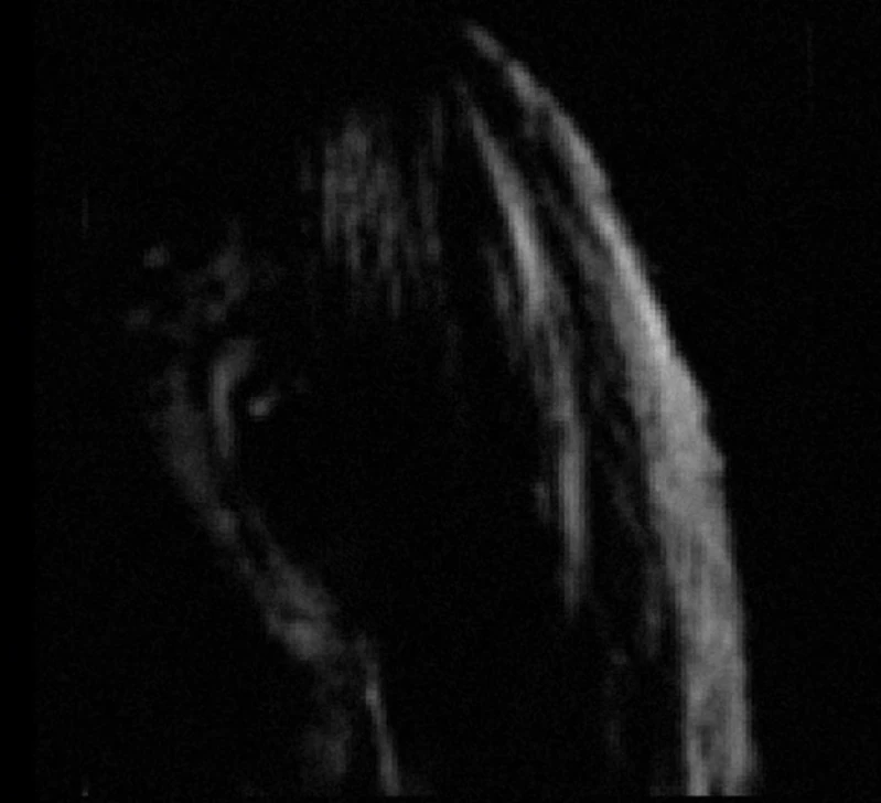 Phase 41 (YellowFour) | The Uncanny Incredible Wiki | Fandom