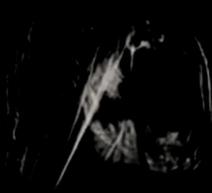 Phase 246 (Stist)/Phase 824 (Gatozerounvalley) | The Uncanny Incredible Wiki | Fandom