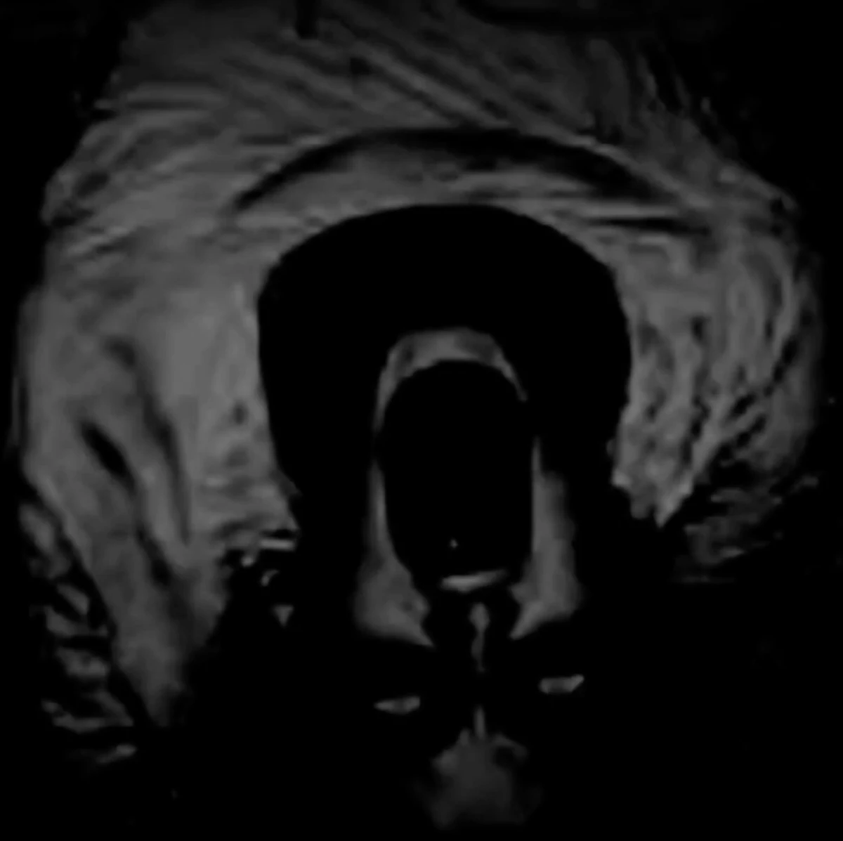 Phase 153 (Augusto) | The Uncanny Incredible Wiki | Fandom