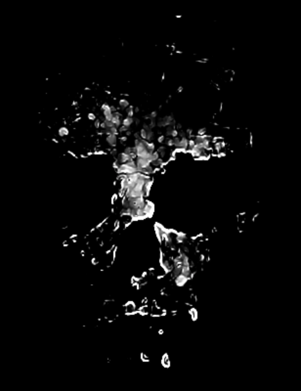 Phase 145 (Memes Everyday) | The Uncanny Incredible Wiki | Fandom