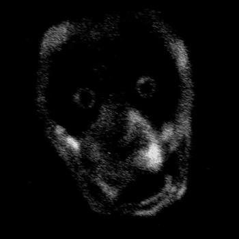 Phase 197 (Gold XD) | The Uncanny Incredible Wiki | Fandom