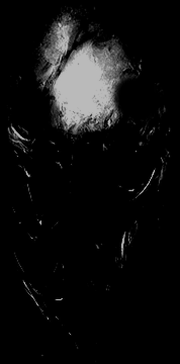 Phase 228 (MIBU 250 Phases) | The Uncanny Incredible Wiki | Fandom