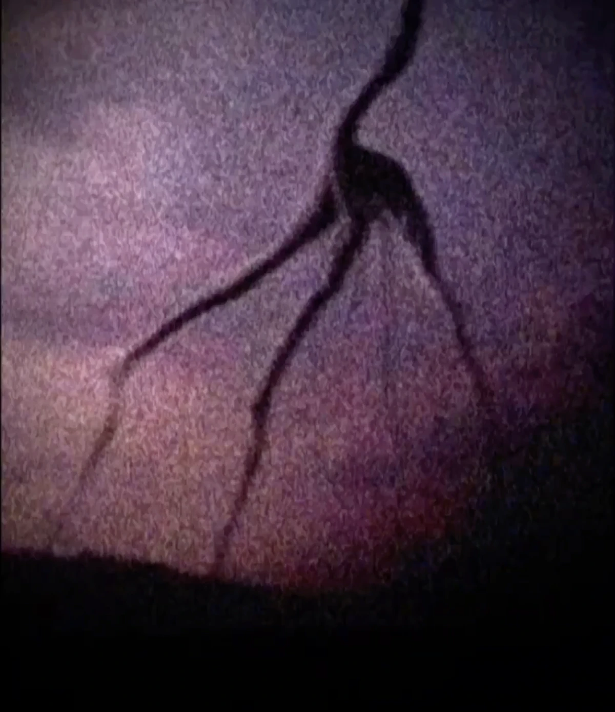 Phase 93 (Memes Everyday) | The Uncanny Incredible Wiki | Fandom