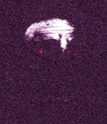 Phase 159 (Gold XD) | The Uncanny Incredible Wiki | Fandom