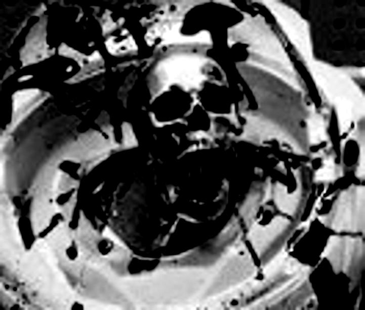 Phase 170 (MIBU 250 Phases) | The Uncanny Incredible Wiki | Fandom Phase 170 (MIBU 250 Phases) | The Uncanny Incredible Wiki | Fandom