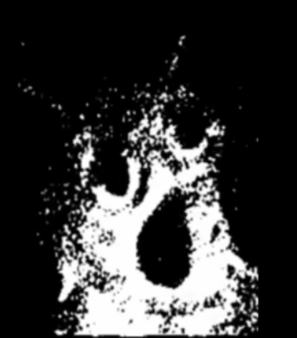 Phase 452 (Stist)/Phase 1112 (ZankuyAE) | The Uncanny Incredible Wiki ...