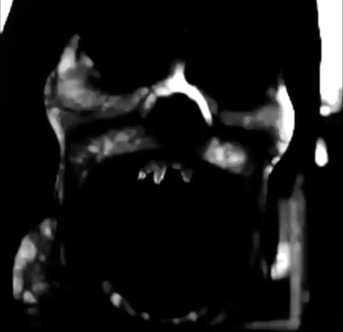 Phase 24 (27dde) | The Uncanny Incredible Wiki | Fandom