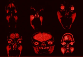 The MRI Demons (Phoenix) | The Uncanny Incredible Wiki | Fandom