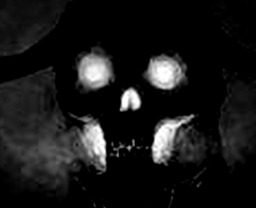 Phase 227 (MIBU 250 Phases) | The Uncanny Incredible Wiki | Fandom