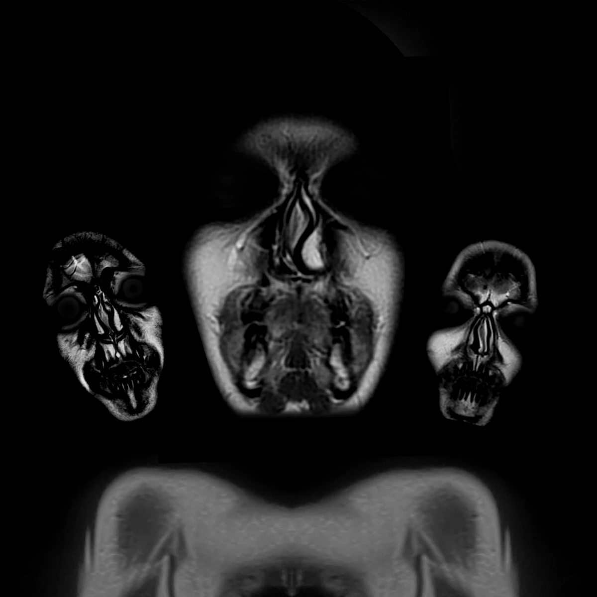 MRI Scan Phase (Topsik22) | The Uncanny Incredible Wiki | Fandom