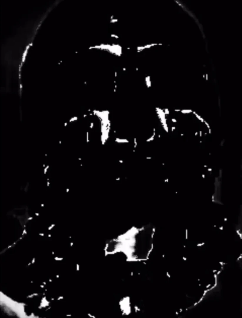 Melting Skull Phase (Slaughterhouse) | The Uncanny Incredible Wiki | Fandom
