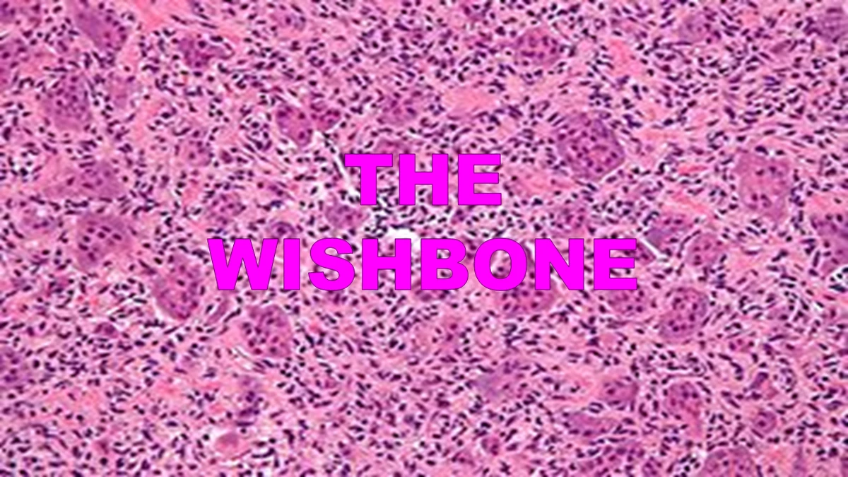 The Wishbone | The Nick Jr. Extravaganza Wiki | Fandom