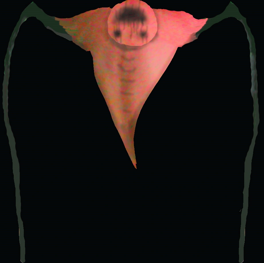 The Skinsect | The Fear Mythos Wiki | Fandom