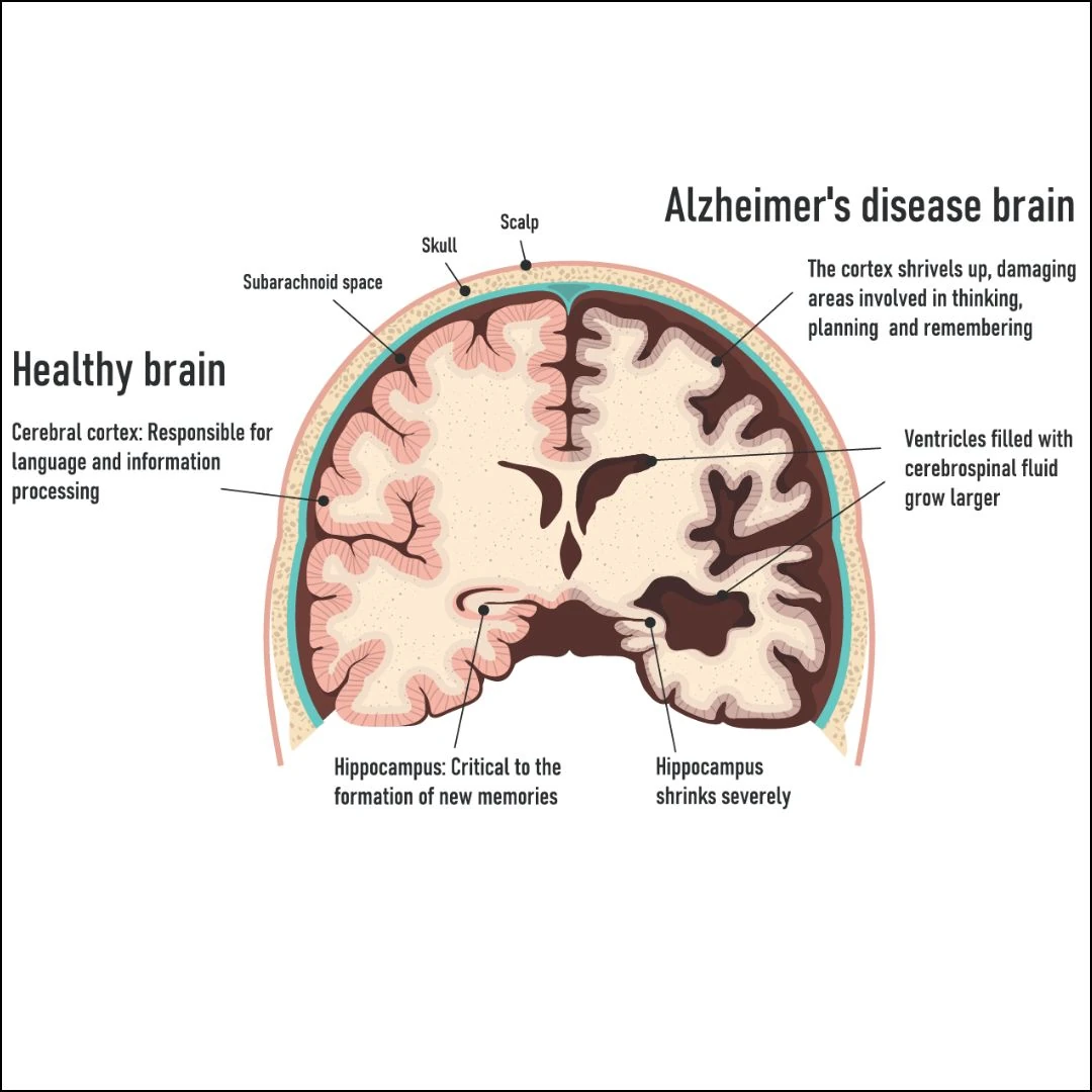 Terminal Breakdown | Loading Script Wiki | Fandom