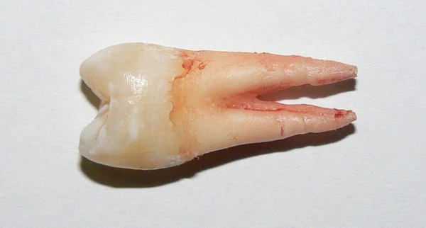 Hallowed Tooth | The Last Stand Wiki | Fandom