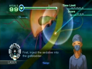 Cholelithiasis | Caduceus Database | Fandom