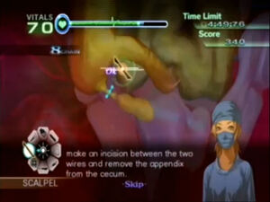 Appendicitis | Caduceus Database | Fandom