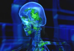Smallville: X-Ray | TV Database Wiki | Fandom