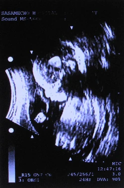 Diclonius (Elfen Lied) | Ultimate Pop Culture Wiki | Fandom