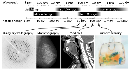 X-ray | Ultimate Pop Culture Wiki | Fandom