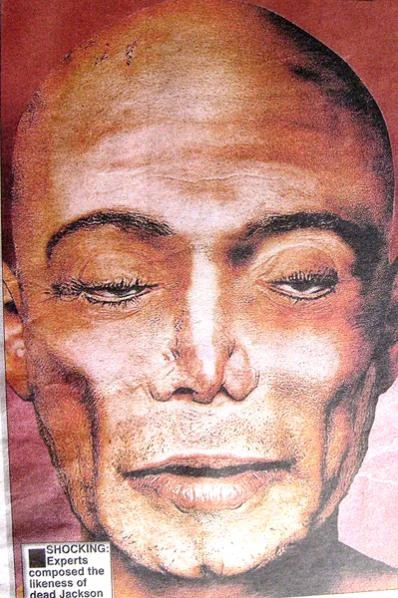 Michael Jackson Autopsy Photo Unedited