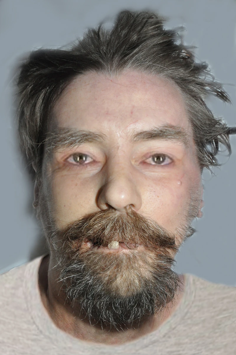 Detroit John Doe (January 2015) | Unidentified Wiki | Fandom