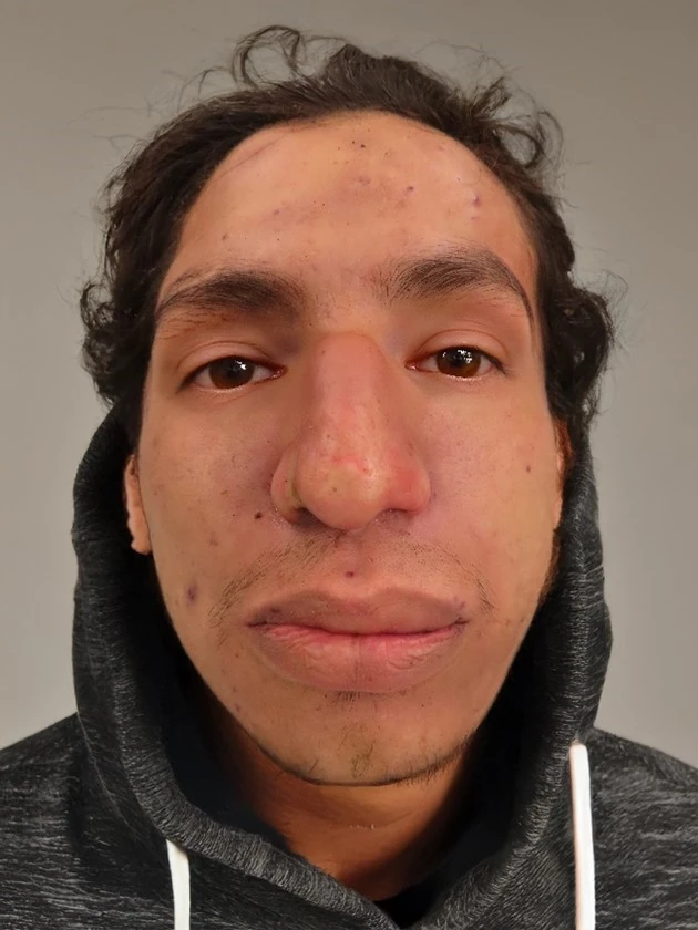 Edmonton John Doe (2024) | Unidentified Wiki | Fandom