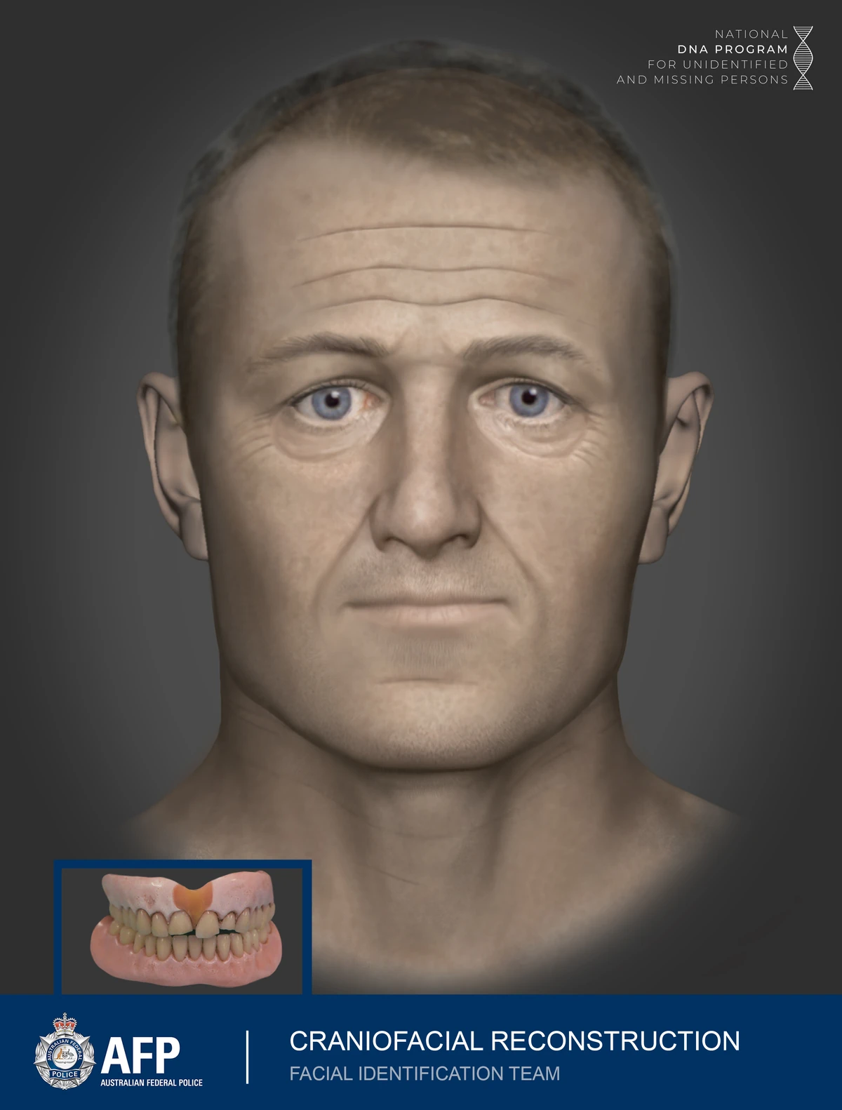 Billy Hardie | Unidentified Wiki | Fandom