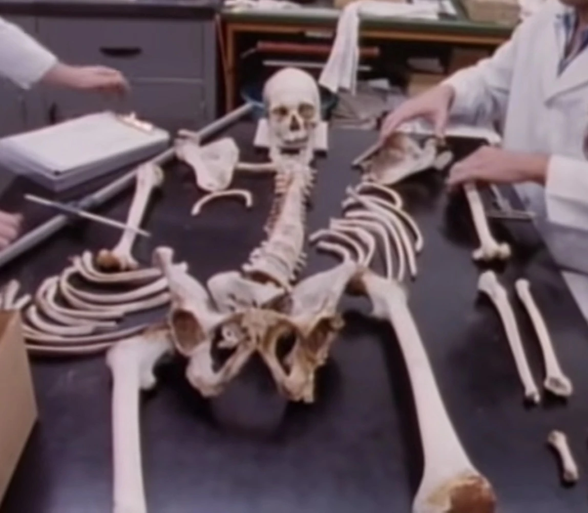 Kolb Skeleton | Unsolved Mysteries Wiki | Fandom
