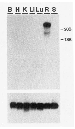 ABCA4 - Ocular Transmembrane Protein | UVM Genetics & Genomics Wiki ...