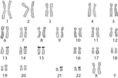 Chromosome banding | UVM Genetics & Genomics Wiki | Fandom