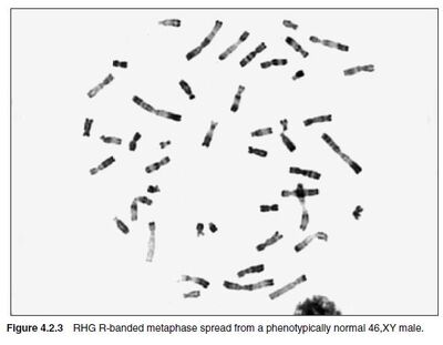 Chromosome banding | UVM Genetics & Genomics Wiki | Fandom