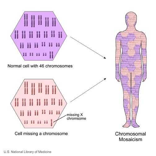 Genetic Mosaicism