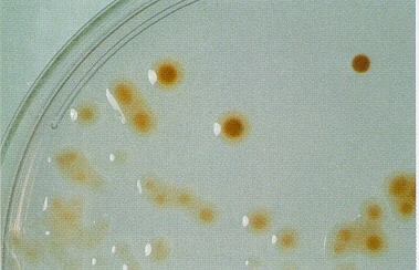 Agrobacterium tumefaciens | UVM Genetics & Genomics Wiki | Fandom