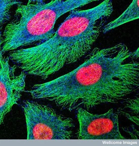 HeLa Cells | UVM Genetics & Genomics Wiki | Fandom
