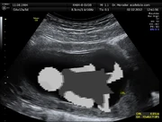 Occeus Coliad | Vast-errror Wiki | Fandom