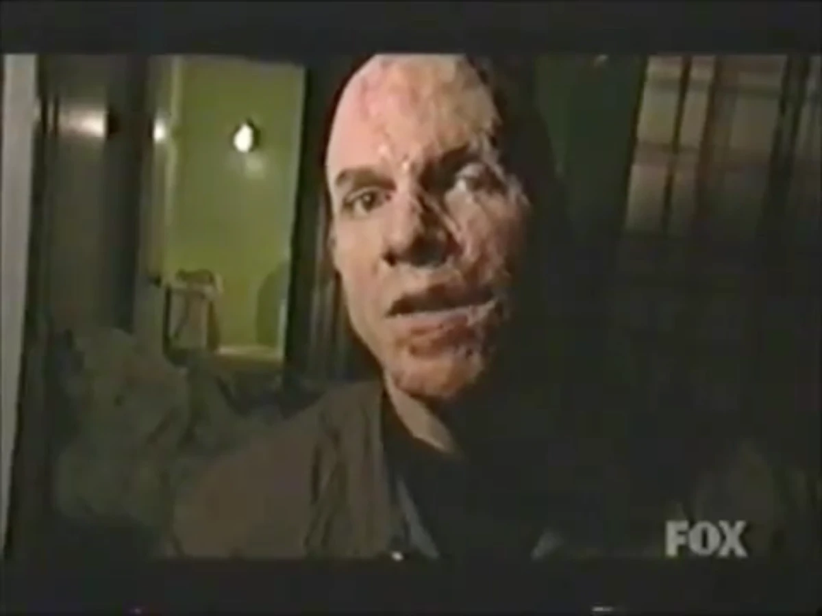 Burnt Man | Villains Wiki | Fandom