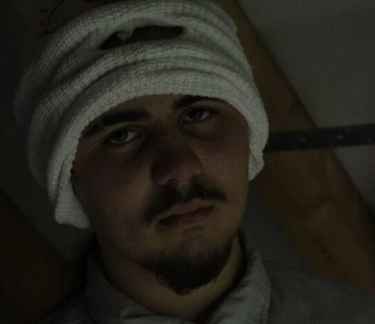 Blink | Villains Wiki | Fandom