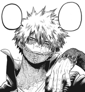 Dabi/Synopsis | Villains Wiki | Fandom