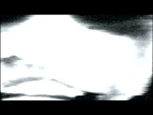 Armless | Villains Fanon Wiki | Fandom