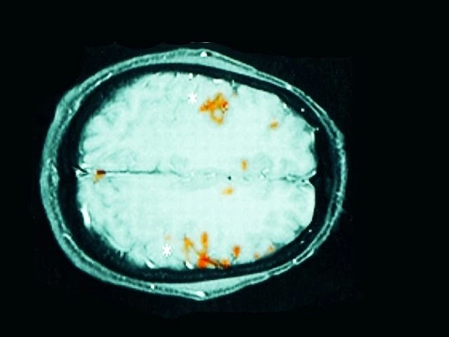 What's Left? | Vsauce Wiki | Fandom